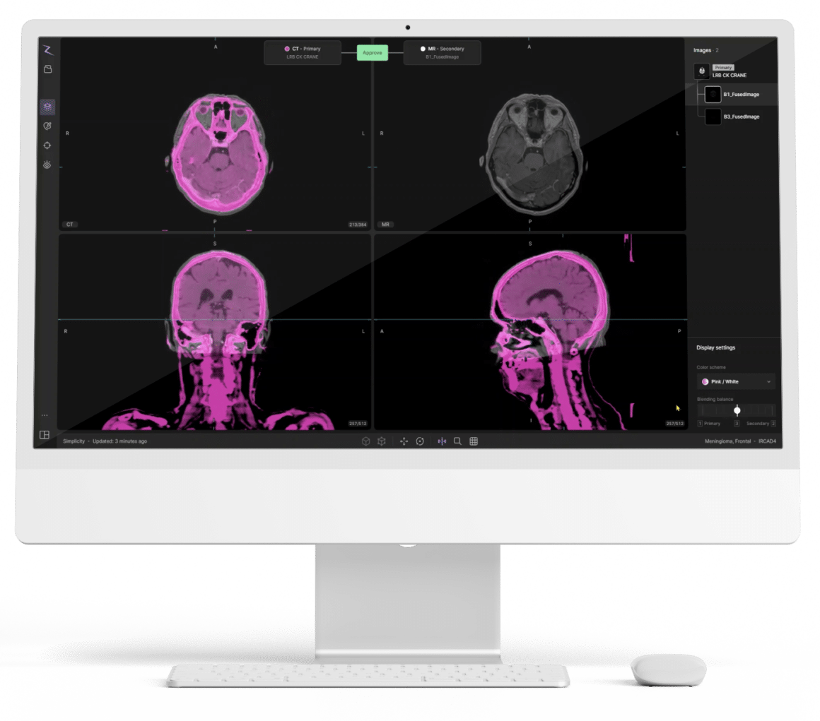 ZAP Unveils the ZAP-Axon® Radiosurgery Planning System