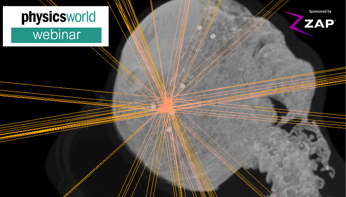 Dedicated vs multi-purpose SRS delivery platforms: is good enough, good ...