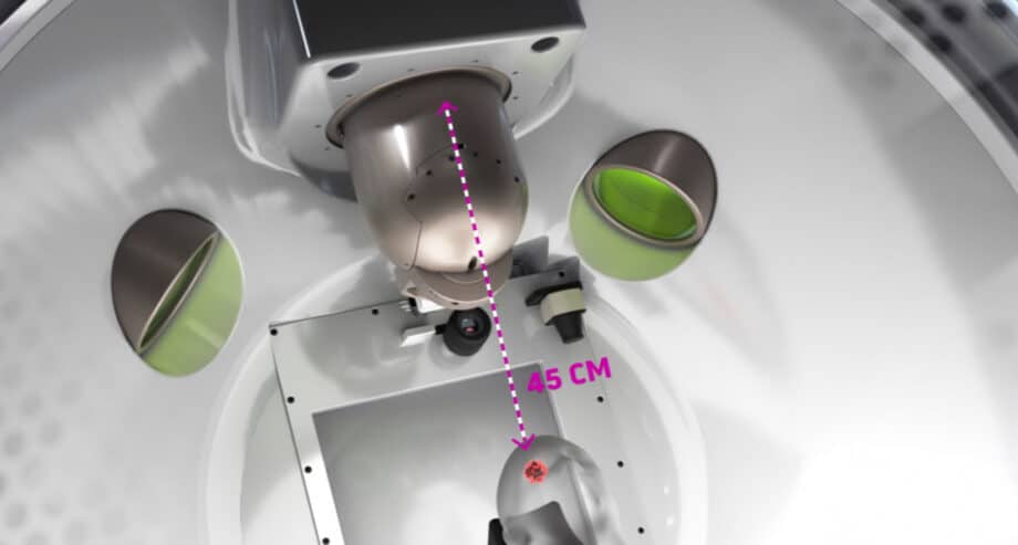 ZAP-X - Gyroscopic Stereotactic Radiosurgery for the Brain